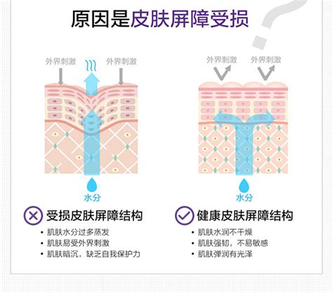 肤质对比