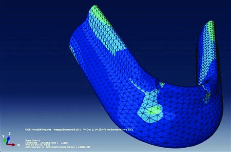 Pattern Of Stress Distribution In Bone Around Long 10 Mm Implants Download Scientific Diagram