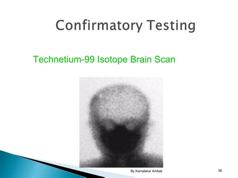 Brain Death Assessment Basic Principles Ppt Brain Death Assessment Basic Principles Ppt