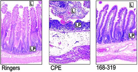 Figure 1 From The Interaction Of Clostridium Perfringens Enterotoxin With Receptor Claudins
