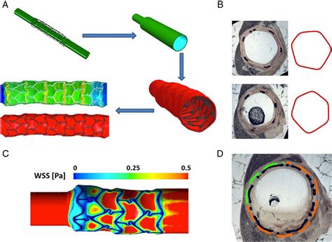 Computational Fluid Dynamics Modelling In Cardiovascular Medicine Heart