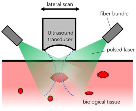 Simulation Study Of Acoustic Resolution Based Photoacoustic Microscopy