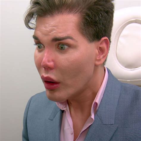 Botched Patient Rodrigo Learns His Nose Could Fall Off