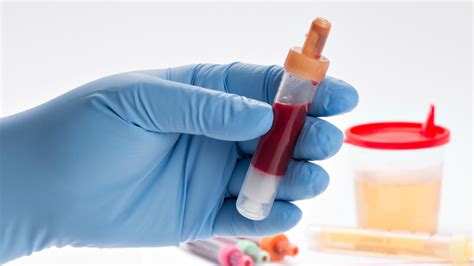 Mycotoxin Testing 101 Everything You Need To Know Zuma Nutrition