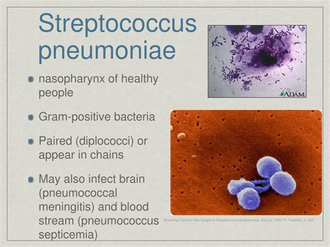 Ppt Streptococcus Pneumoniae Powerpoint Presentation Free Download Id 6601980