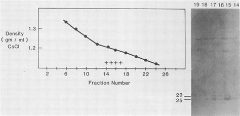 Cscl Density Equilibrium Centrifugation Of An Hbsag Positive Serum From Download Scientific
