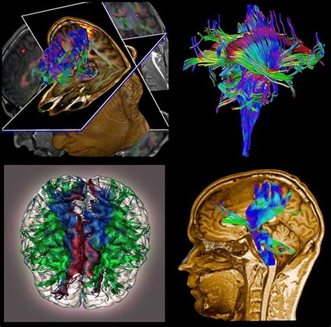 DTI Schematic Diagram Download Scientific Diagram