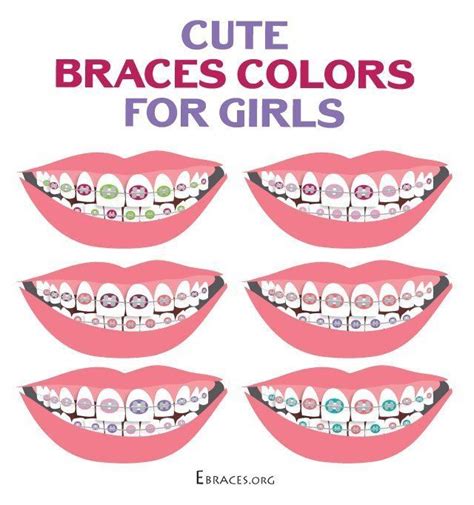 137 Best Braces Colors Images On Pinterest Braces Colors Teeth And