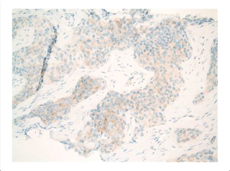 Staining Positive For Synaptophysin Download Scientific Diagram