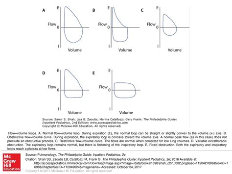 Flow Volume Loops A Normal Flow Volume Loop Ppt Download