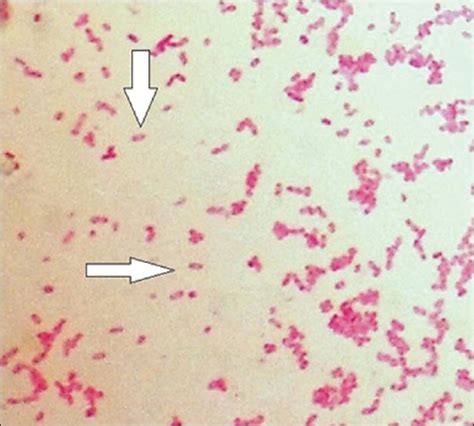 Gram Negative Bacilli Rods Microbiology Learning The Whyology Of Microbial Testing