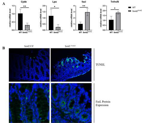 Setd2 Deficiency Promotes Inflammatory Bowel Disease Via Oxidative Stress And Fasl Mediated