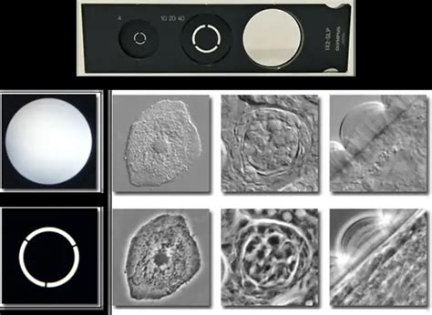 Phase Contrast Microscopy Principle Parts Uses Biology Notes Online