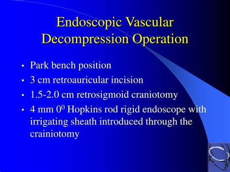 Ppt Fully Endoscopic Vascular Decompression Of The Trigeminal Nerve Powerpoint Presentation