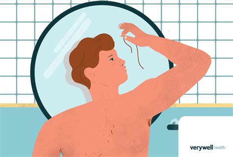 Low Testosterone Causes Symptoms Diagnosis And Treatment