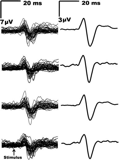Individual Averaged And Grand Averaged Cvemp Waveforms Obtained From