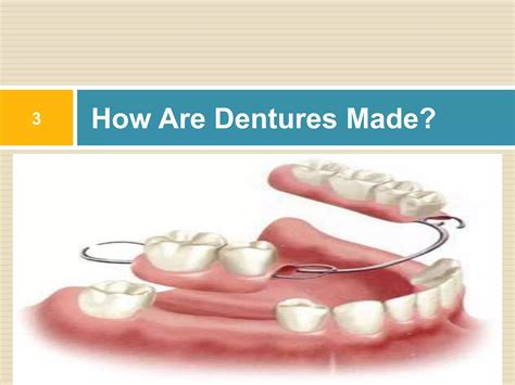 Steps Of Fabrication Of Removable Partial Denture Pptx