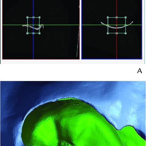 A Volume Of Interest Of Silicone Specimen Digitized By Microcomputed