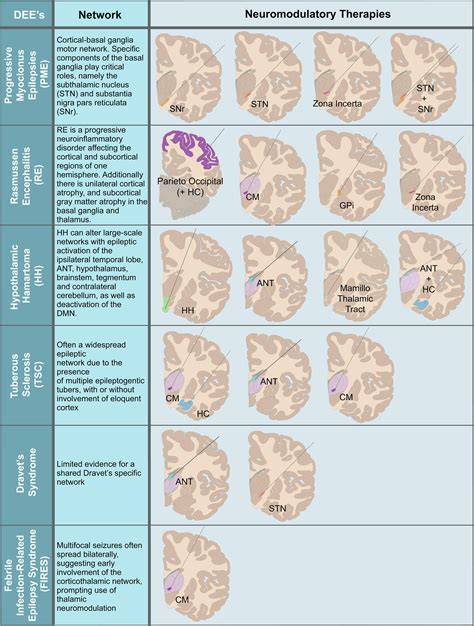 Neuromodulation Strategies In Developmental And Epileptic Encephalopathies Epilepsy And Behavior