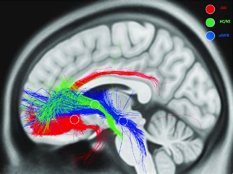 Three Common Pathways For Psychiatric Deep Brain Stimulation Download Scientific Diagram