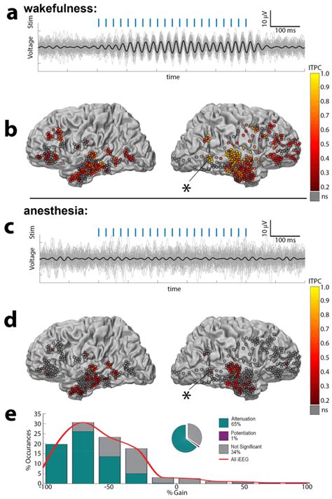 Anesthesia Induced Loc Disrupts Auditory Responses In Association