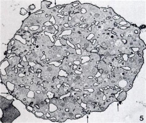 Figure 5 From The Demarcation Membrane System Of The Megakaryocyte A Misnomer Semantic Scholar