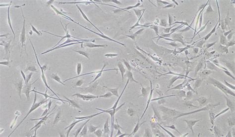 How To Get Rid Of Fibroblastic Contaminating Cells Tebubio