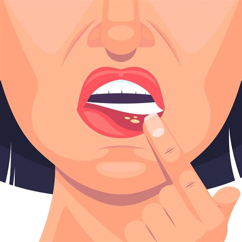 Oral Cancer Symptoms Early Signs And How To Take Action