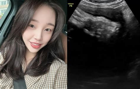 스타들의 임신·출산 소식 `만삭` 백아연 출산 임박했다…`결국 유도 분만 뱃속에서 노는 게 좋은 건지` Zum 뉴스