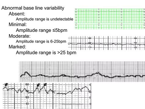Ctg Patterns Pdf