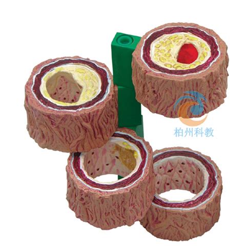 人体血管病理解剖模型 上海柏州科教设备有限公司