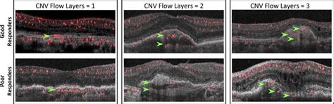 Examples Of Cnv Membranes With Increasing Cnv Flow Layers Top Row
