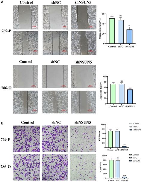Knockdown Of Nsun5 Inhibited Ccrcc Cell Migration And Invasion A The
