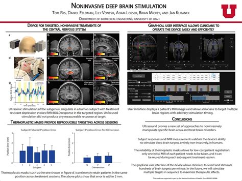 Non Invasive Deep Brain Stimulation Using Focused Ultrasound Waves Office Of Undergraduate