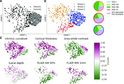 Non Linear 2d Umap Embedding Of Lesional T 1 Features A Manual Download Scientific Diagram