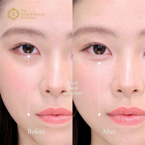 Aegyo Sal Shading Singapore Korean Under Eye Shading Youthful Eye