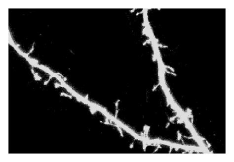 A Roi Of The Original Image B Detection Result Of The Spines