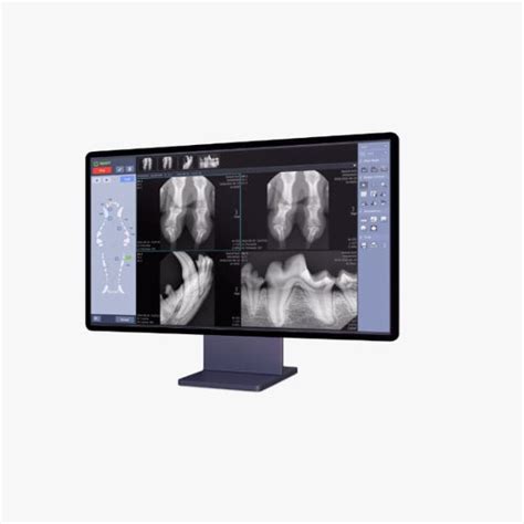 Operating Room Software Ez Dent Vet Rayence For Control Viewer Diagnostic
