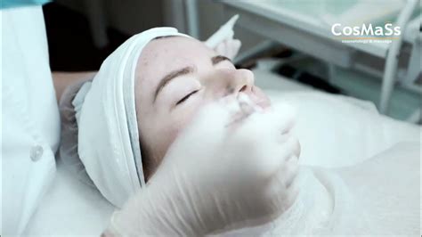 Чистка лица Лечение акне Пилинг Закрытые комедоны милиумы очищение пор Youtube