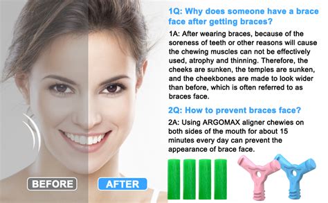 Y Type Aligner Chewies Y Shape Tooth Aligner Chewies Y Aligner Chewies 10stk