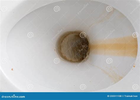Close Up Dirty Toilet Bowl Traces Of Limescale And Rust Stock Photo Image Of Dirty Toilet