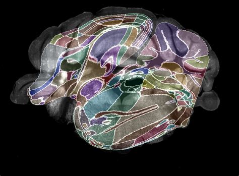 Brain Registration Issue Usage Issues Image Sc Forum
