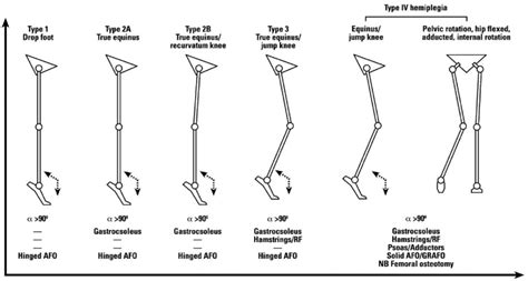 Gait Patterns And Management Algorithm For Unilateral Spastic Cerebral Download Scientific