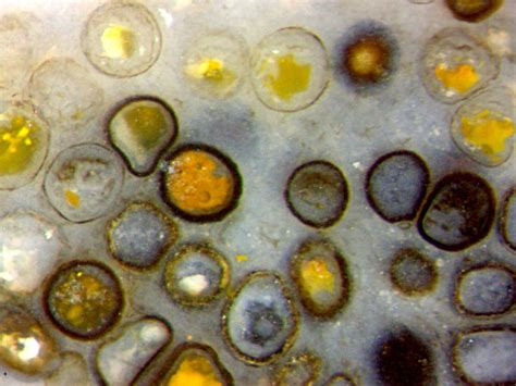 Fungusrestingspores