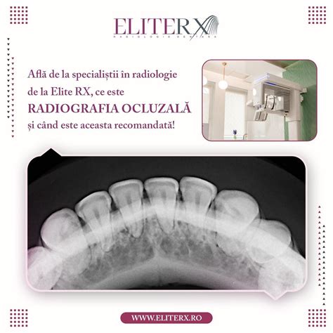 Radiologie Dentara Popeni