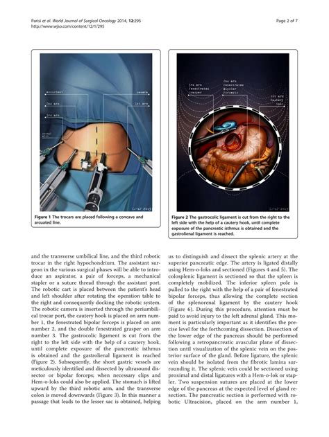 Solution Robotic Distal Pancreatectomy With Or Without Preservation Of Spleen A Technical Note