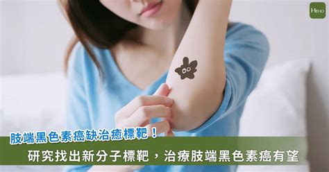 治療肢端黑色素癌有望研究揪出新分子標靶與黑色素皮膚癌大不同 Heho健康 LINE TODAY