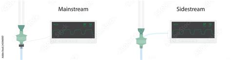 Different Types Of Capnography Measurement Mainstream Versus