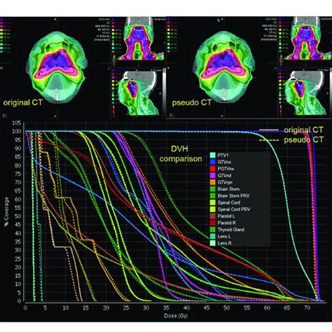 Prediction Performance Comparison Of U Net And Pix2pix Gan Download