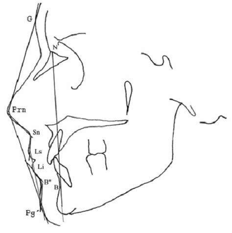 Angular Measurements Download Scientific Diagram